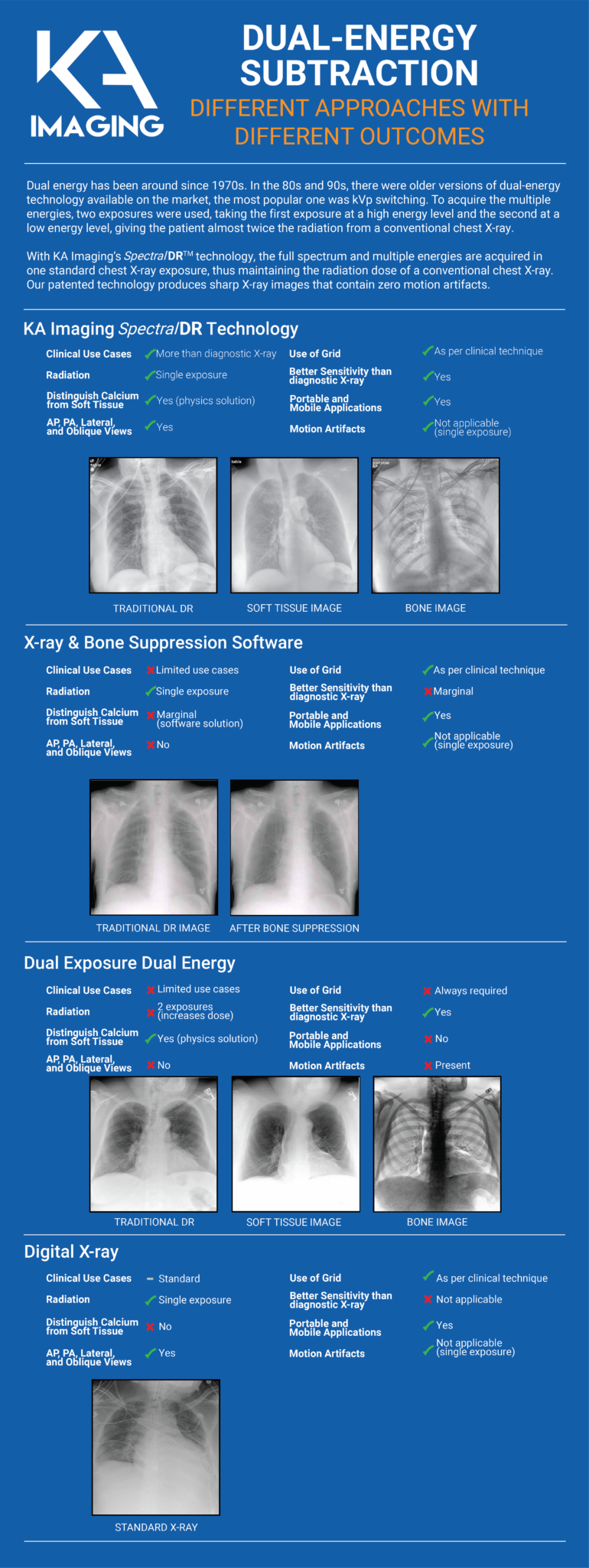 Dual Energy Subtraction Different Approaches With Different Outcomes Ka Imaging