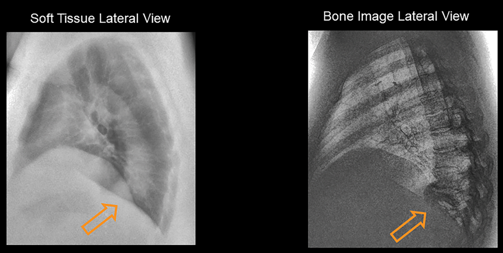 Why Quality X-ray Matters for Accurate Diagnosis | KA Imaging